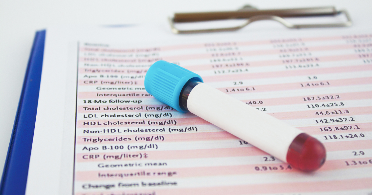 Type 2 diabetes, HIV, and tuberculosis in South Africa - idea hub at BUSPH